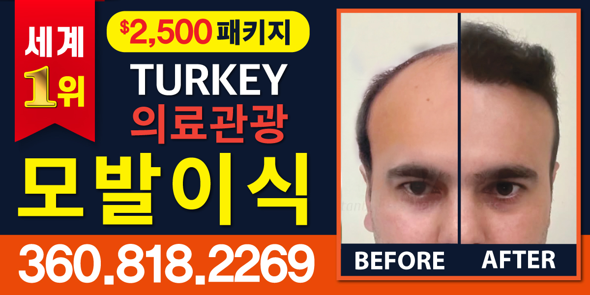 사고 + 팔기 Archives - WowSeattle Seattle KCR